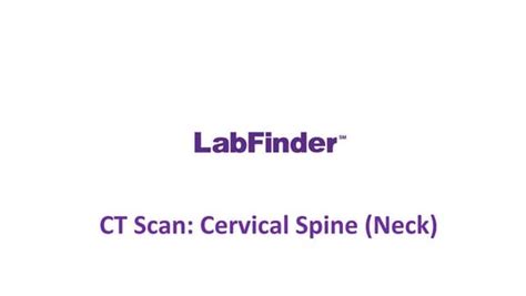 Pediatric Cervical Spine Clearance A Review And Understanding Of The