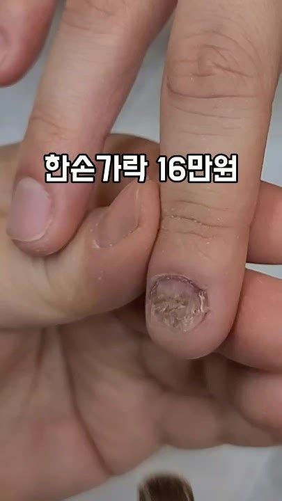 이유가 있겠죠 아크릴연장 물어뜯는손톱 손톱연장 손톱교정 Youtube