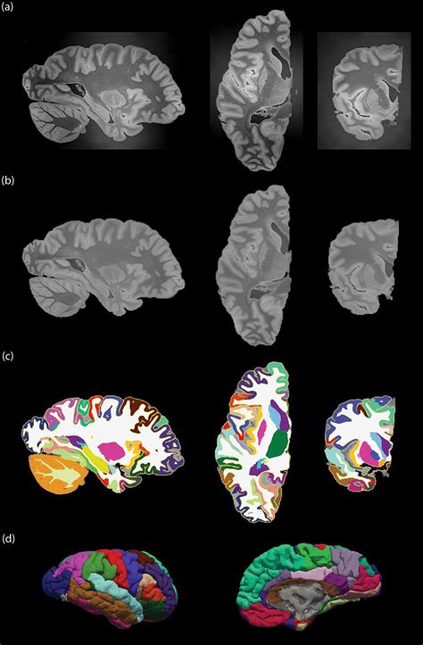 Overview Of The Main Mri Preprocessing Steps A The Raw Ex Vivo Mri Download Scientific