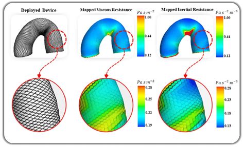 Mapping The Local Pm Parameters Viscous And Inertial Resistances To A