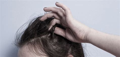 Why Has Scalp Popping Gone Viral ⋆ Chimere Nicole