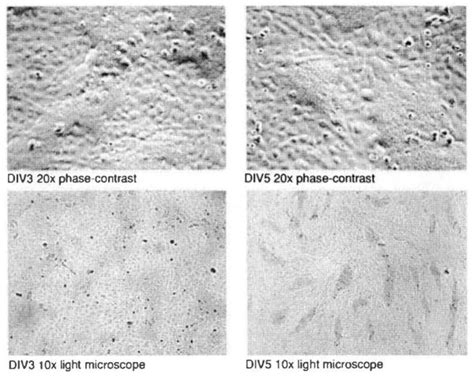 Preparation Of Rodent Testis Co Cultures Abstract Europe Pmc