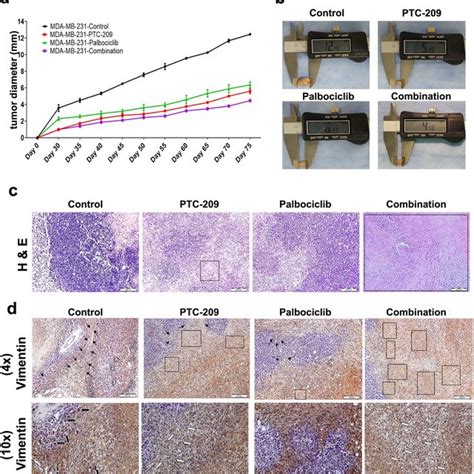 Effects Of Ptc 209 In Combination With Palbociclib Against Hct116 And