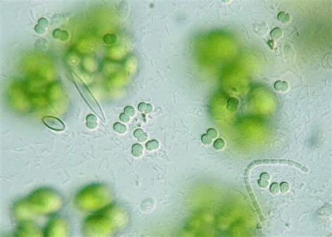 Prokaryote Chroococcales Chroococcus