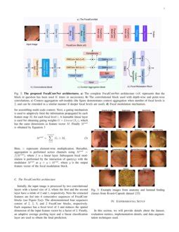 Video Capsule Endoscopy Classification Using Focal Modulation Guided