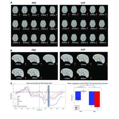 Source Modeling Suggested An Inhibitory Activation Of Medial Download Scientific Diagram