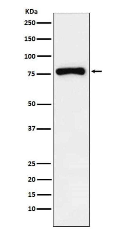 Rnase L Antibody Sr2243 Novus Biologicals 100 μg Unconjugated
