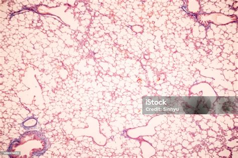 광학 현미경으로 본 인간의 폐 병리학 폐는 인간의 호흡기 기관입니다 코르티기관에 대한 스톡 사진 및 기타 이미지 코르티기관
