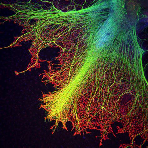 Neurons Growing Over Astrocytes In A Human Stem Cell Embryo Body