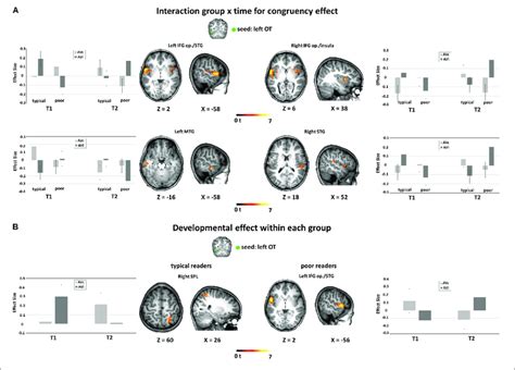 Fc Fmri Analysis Interaction Between Group And Time For The Download Scientific Diagram