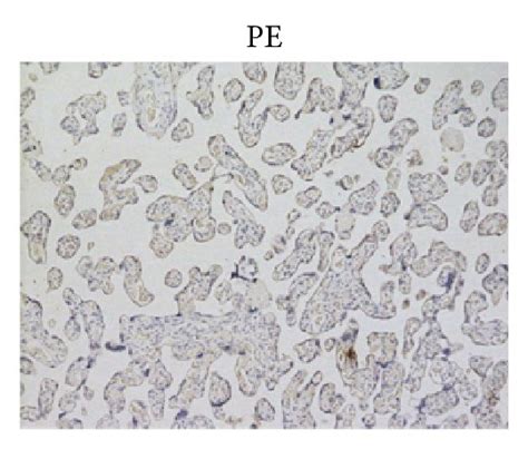 Analysis Of Il 27 And Il 27 Receptor Expression In Placental Tissues
