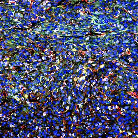 Leica Microsystems On Linkedin Spatial Architecture Of Tumor And