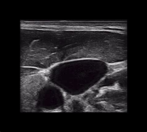 Pal Hd3 Dual Array Wireless Ultrasound For Whole Body Imaging Clarius