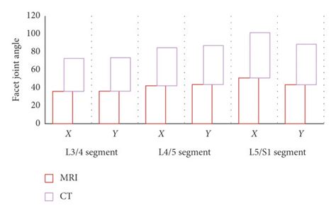 Comparison Of Mri And Ct Measurement Of Facet Joint Angle Download