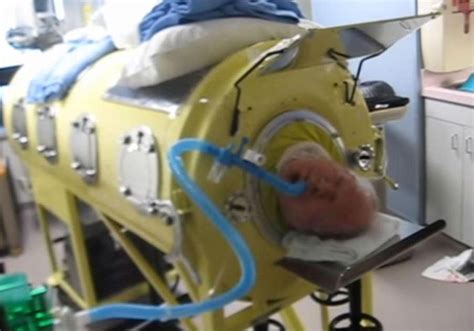 Americas Last Iron Lung Users On Their Lives Spent Inside Obsolete