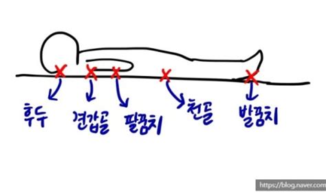 핵심 술기 욕창관리 및 낙상예방간호 술기대사 네이버 블로그