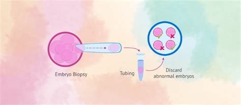 The Different Types Of Embryo Biopsy Techniques