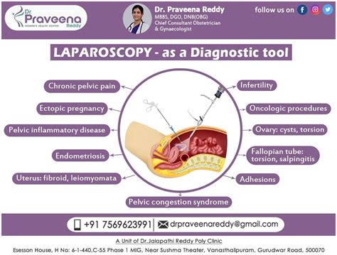 Dr Praveena Reddy On Linkedin Laparoscopy Pelvic Drpraveenareddy Women