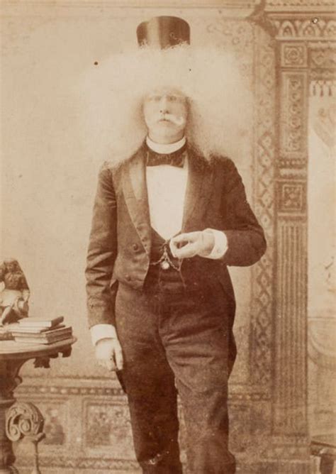 The Striking Story Of Unzie Australias Albino Aborigine Man