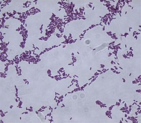 Bacillus Subtilis An Overview And Applications