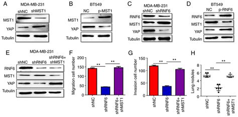 Rnf6 Regulates Yap Induced Bc Migration And Invasion In An