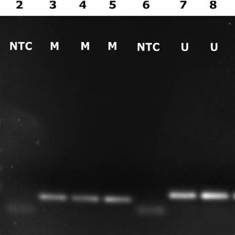 An Example Of Imagej Software Analysis Performed After The Msp Download Scientific Diagram
