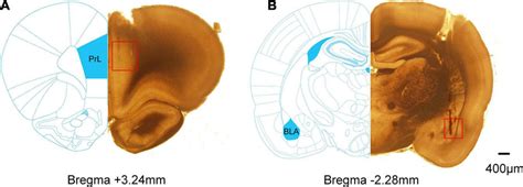 Histological Examinations Of The Electrode Sites In The Mpfc And Bla Download Scientific