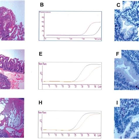 Pdf Involvement Of The Serrated Neoplasia Pathway In Inflammatory