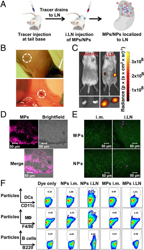 Intranodal Injection Of Polymer Particles A Intralymph Node Download Scientific Diagram