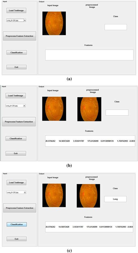 Proposed Technique Matlab Gui Windows A Test Retinal Fundus Image Load