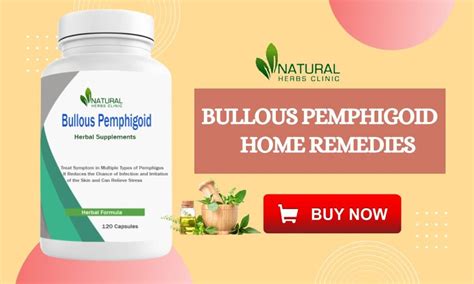 Treatment Of Bullous Pemphigoid With These Best Herbal Elements Sendwood