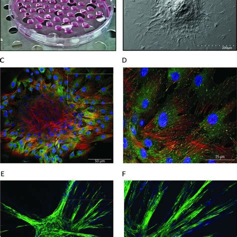 Spherical Aggregate Of Mscs Spherical Aggregates Generated By Download Scientific Diagram