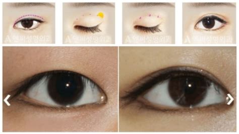 Monolid Vs Double Eyelid Captions Casual