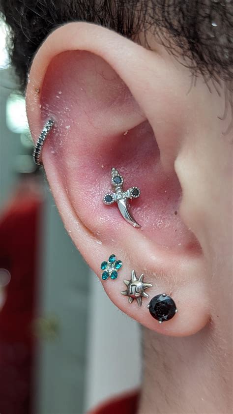 Piercing Bump And General Guidance For Helix And Conch Rpiercing