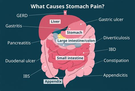 Lower Abdominal Pain Symptoms Causes And Treatment 59 Off