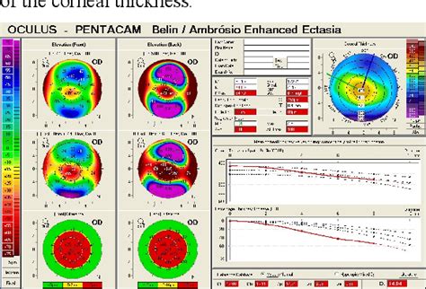 Figure 1 From Keratoconus Detection Algorithm Using Convolutional