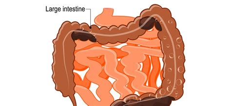 Constipation Causes Symptoms And Treatment