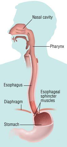 Esophagitis Guide Causes Symptoms And Treatment Options