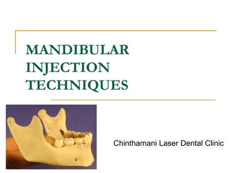 Mandibular Injection Technique PPT Ear Nose And Throat Conditions Diseases And Conditions