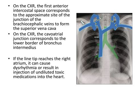 Lines And Tubes In Xray Pptx