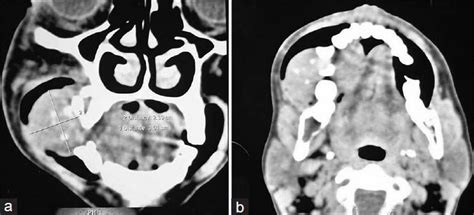 Evidence Based Solving Approach In Diagnosis Of Primary