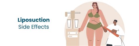 Liposuction Side Effects Types And Complications