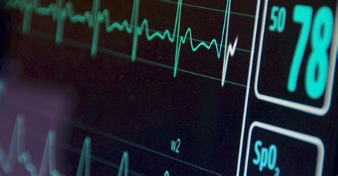 7 Factors To Consider When Purchasing A New Telemetry System