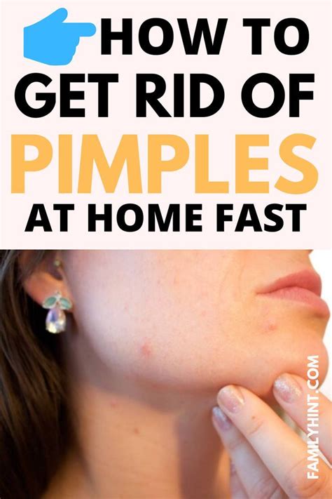 Pimples Artofit