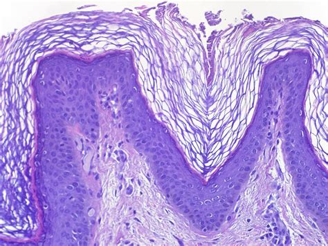 Virtual Grand Rounds In Dermatology 20 Carp