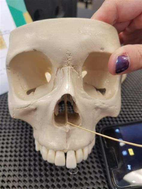 Bone Practical Part 1 Diagram Quizlet
