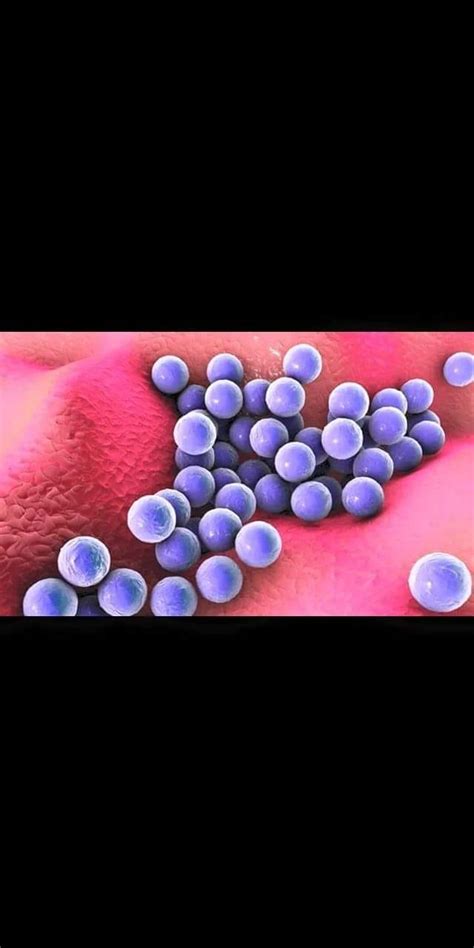 Doctor Kwabina Staphylococcus Lead To Infertility Staphylococcus Aureuss Is The Immune