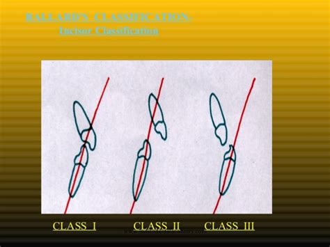 Classification
