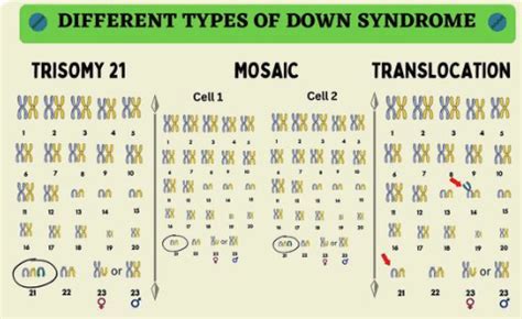 What Are Mosaic Down Syndrome Symptoms Goally