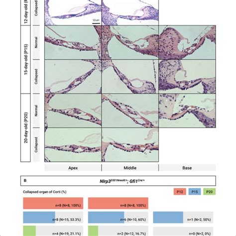Chronological Evaluation Of Cochlear Morphology In Nlrp3 D301nneor Download Scientific